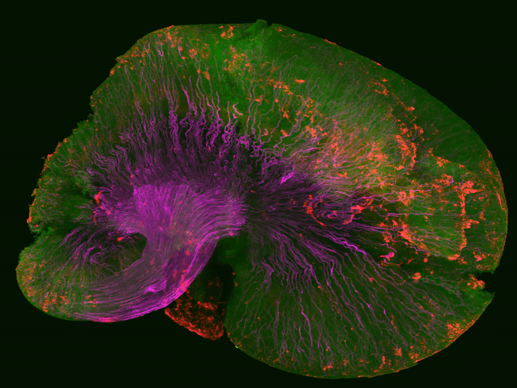 WashU Center for Cellular Imaging (WUCCI) | Research | WashU
